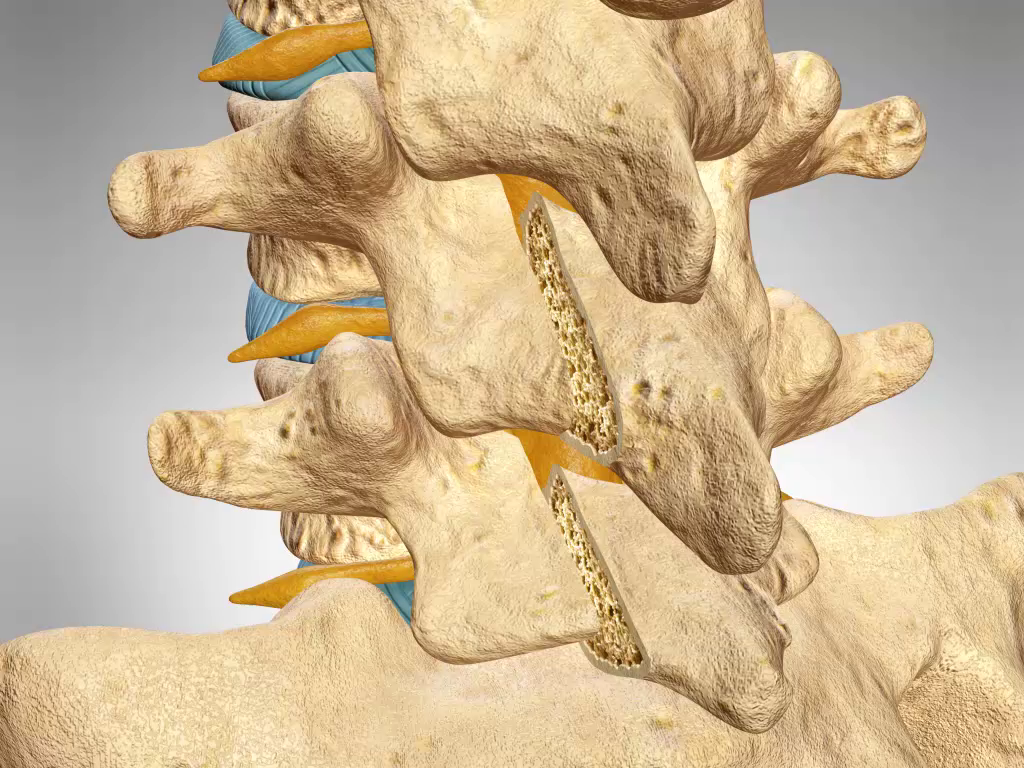 RasouliSpine | Spine Procedures | Dr. Alexandre Rasouli, M.D.