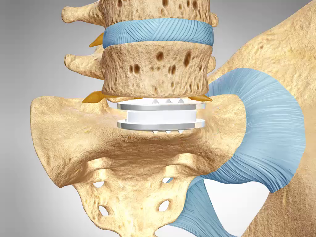 RasouliSpine | Spine Procedures | Dr. Alexandre Rasouli, M.D.