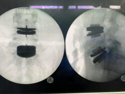 Dr. Alexandre Rasouli Becomes First Surgeon in the US to Use the ...