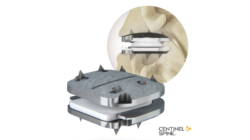 Dr. Rasouli Performs First prodisc® C Vivo Procedure in Western US ...